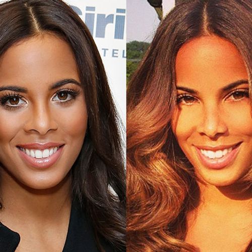 Miley Cyrus Nose Job Before And After