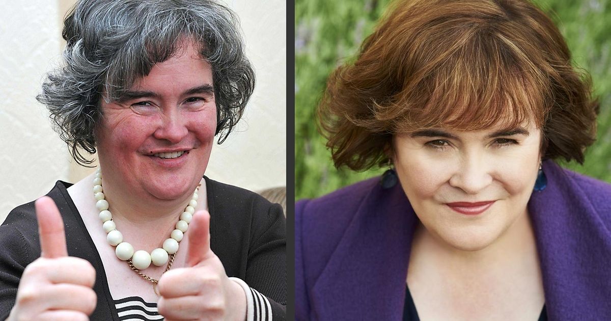 Susan Boyle : Son incroyable transformation ! (avant/après)