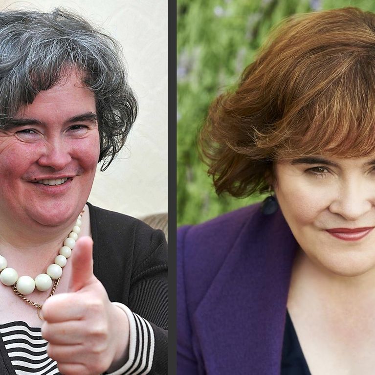 Susan Boyle : Son incroyable transformation ! (avant/après)