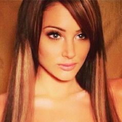 Celebrities who use Botox: Frozen in time