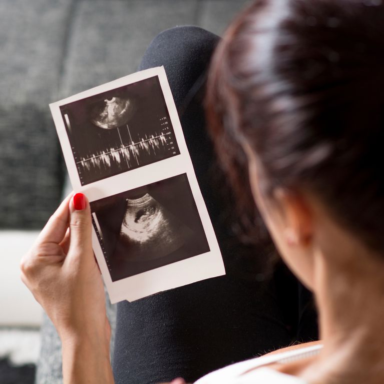 Die 9. SSW (Schwanger­schafts­woche) auf einen Blick