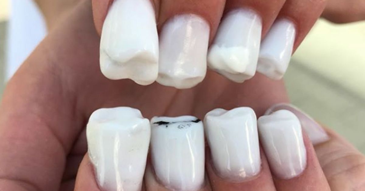 Molar Nails, la dernière tendance nail art déjantée