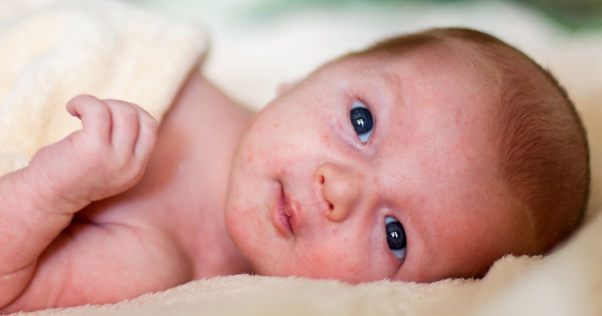 Comment reconnaître les maladies infantiles