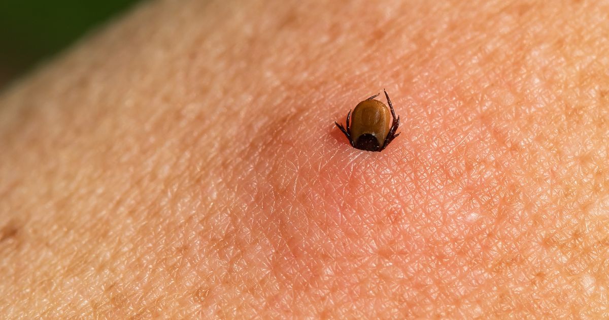 Tout savoir sur la maladie de Lyme