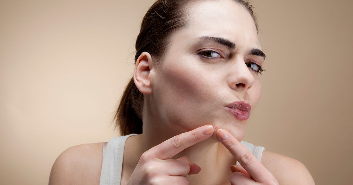 Bouton au menton : comment m’en débarrasser