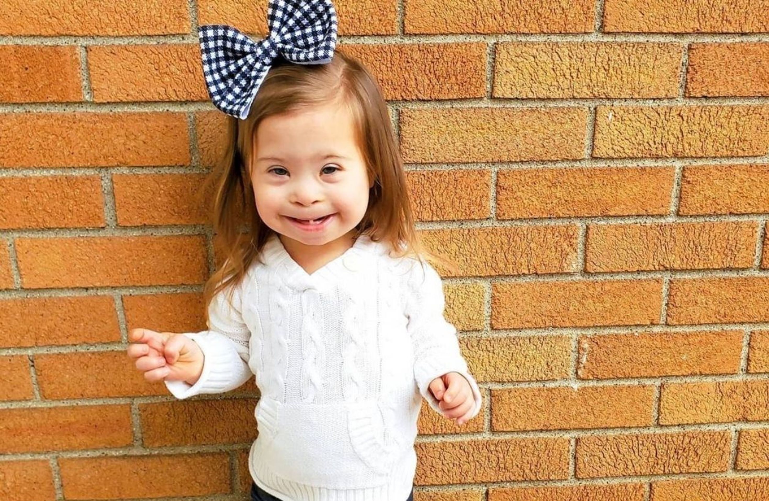 Handicap : maman d'une fille atteinte de trisomie, elle demande plus d ...