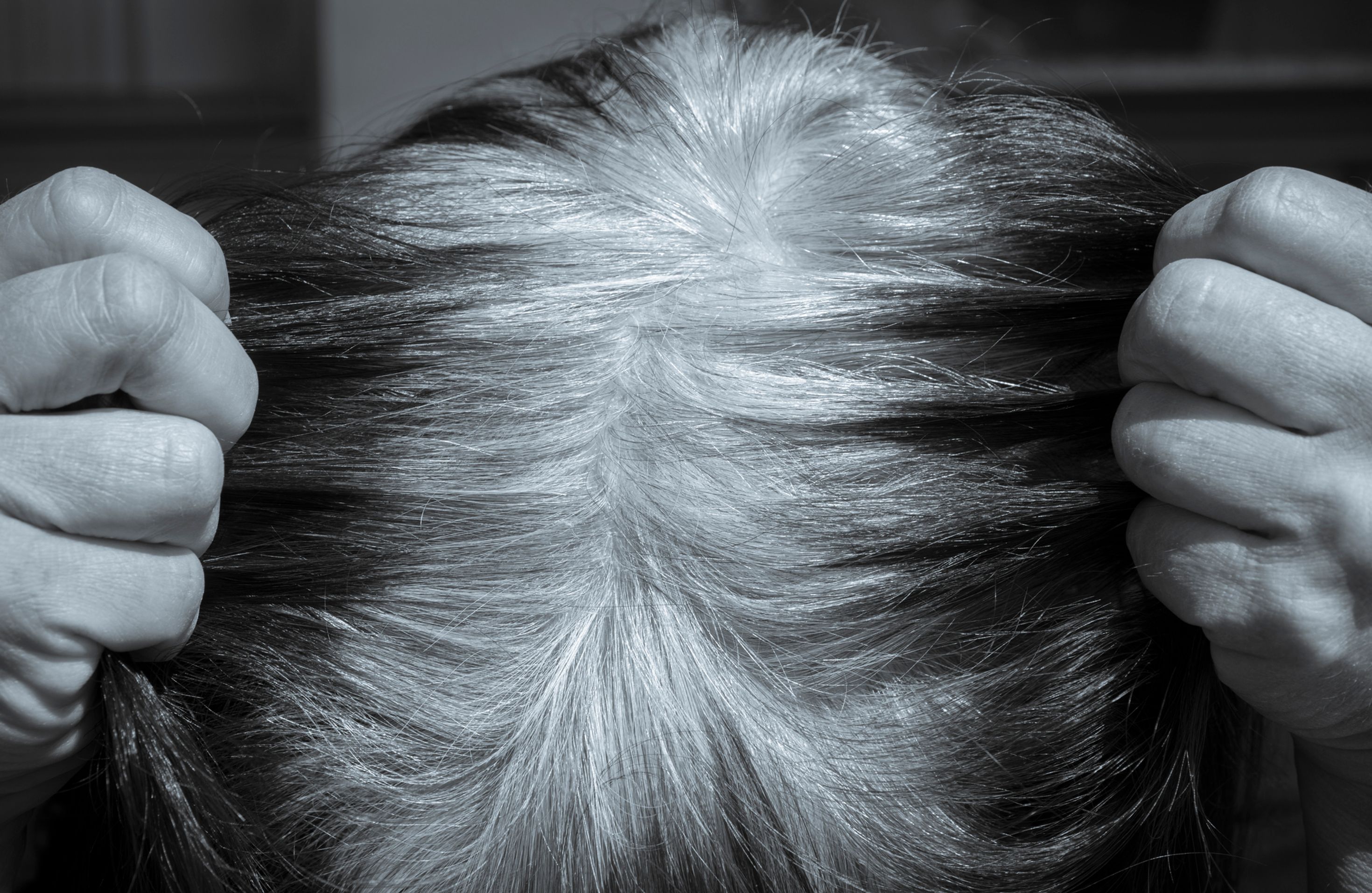 "Scalp popping" : un dangereux challenge fait fureur sur tiktok