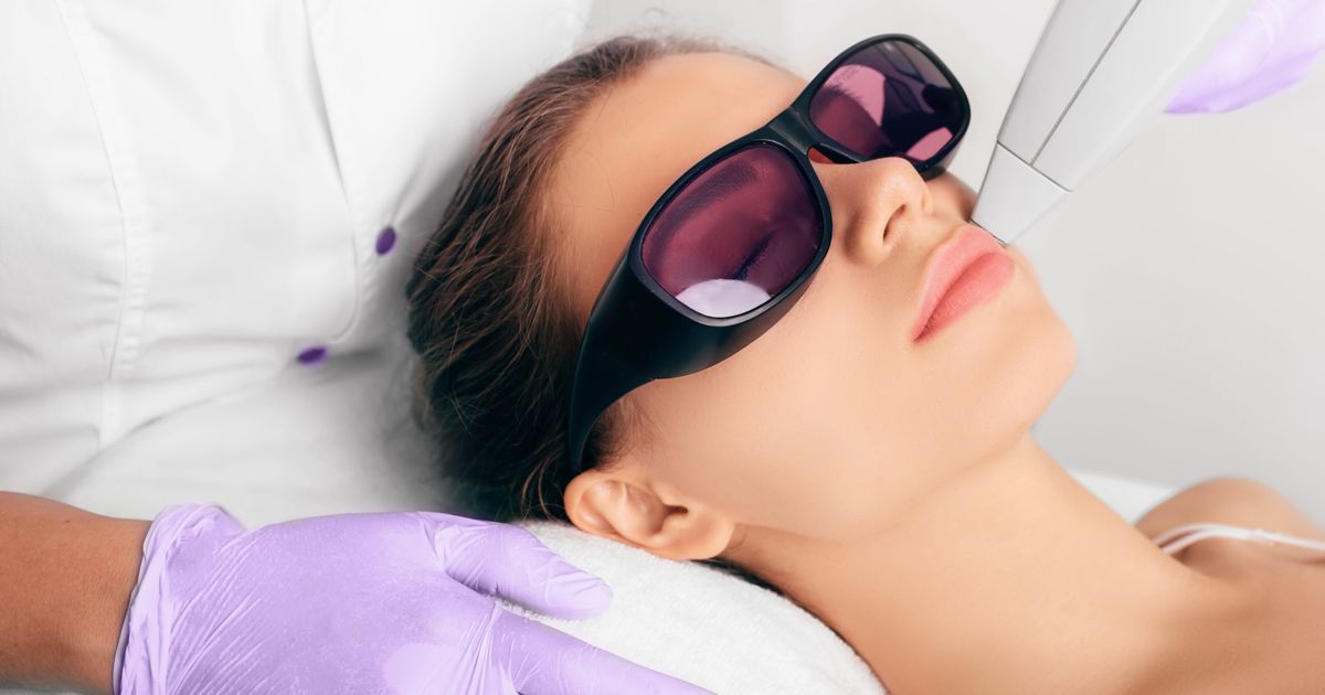 Épilation laser du visage : tout ce que vous avez besoin de savoir ...