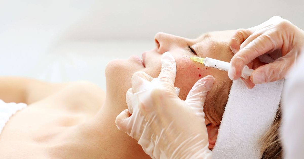 Vampire Lift : c'est quoi ce soin conseillé par Kim Kardashian et qui a ...