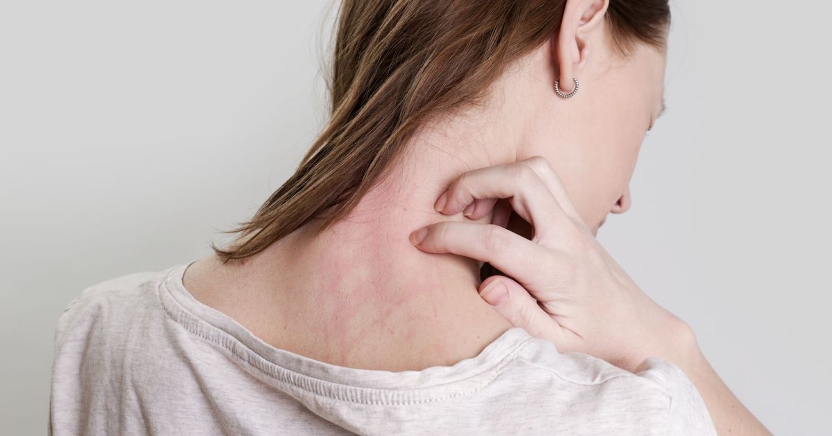 Boutons dans le cou : causes, traitements et conseils pour s'en débarrasser