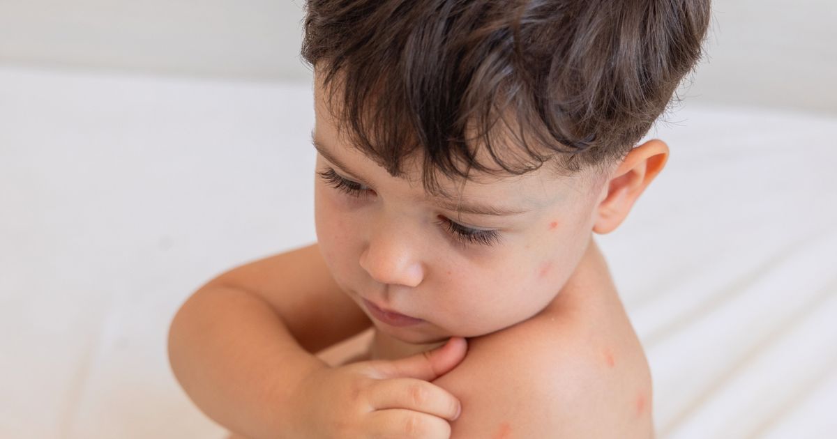 Syndrome de l’oreille rouge printanière chez l’enfant : voici les 3 ...