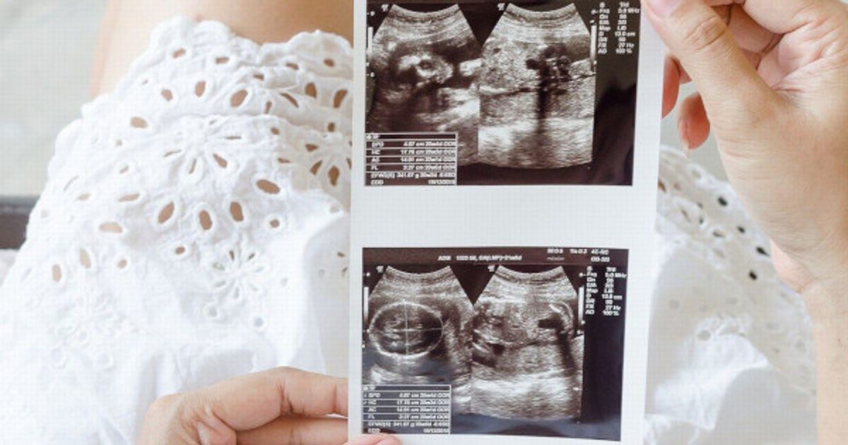 Das ist die 12. SSW (Schwanger­schafts­woche) auf einen Blick